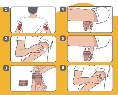 Getting started | DiaExpert